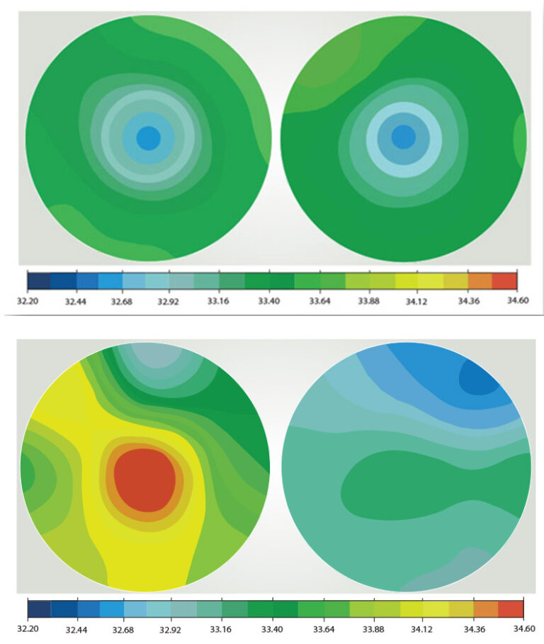 EWB Bio Mammo Scan – EW Biomedical